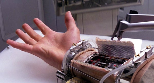 Científicos mejoran un brazo prostético llamado como Luke Skywalker